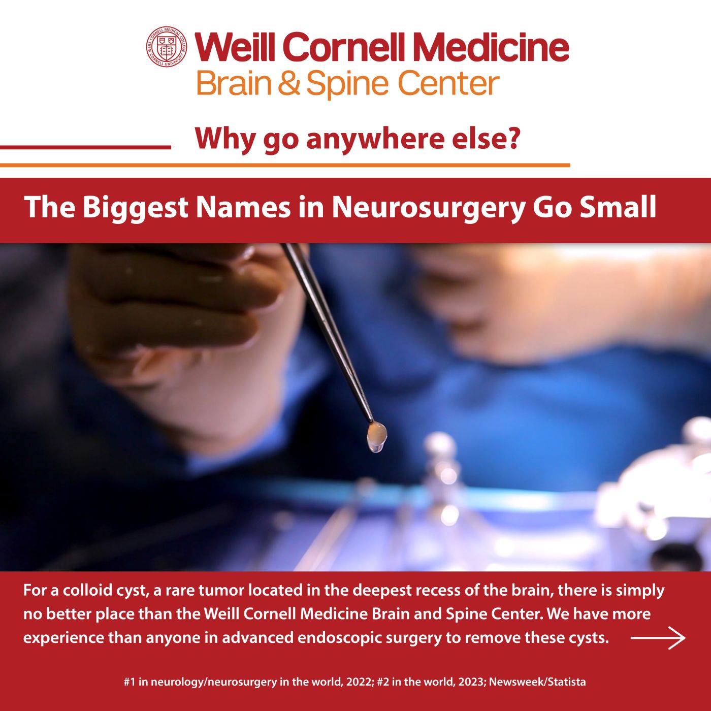 Colloid Cysts Neurological Surgery